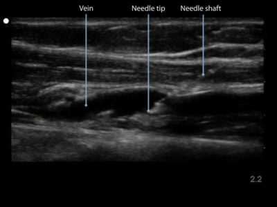 SonoSim Releases Nurse Ultrasound Curriculum – SCT