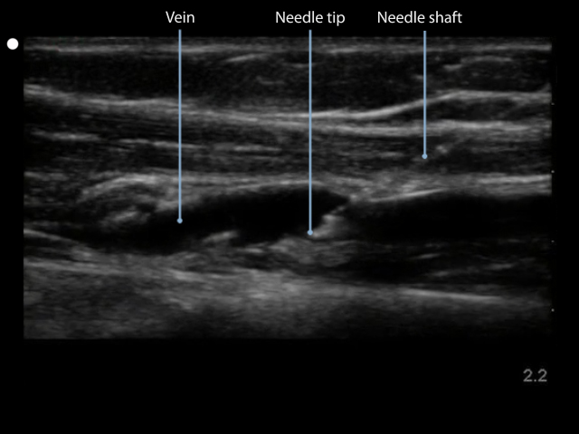 SonoSim Releases Nurse Ultrasound Curriculum – SCT